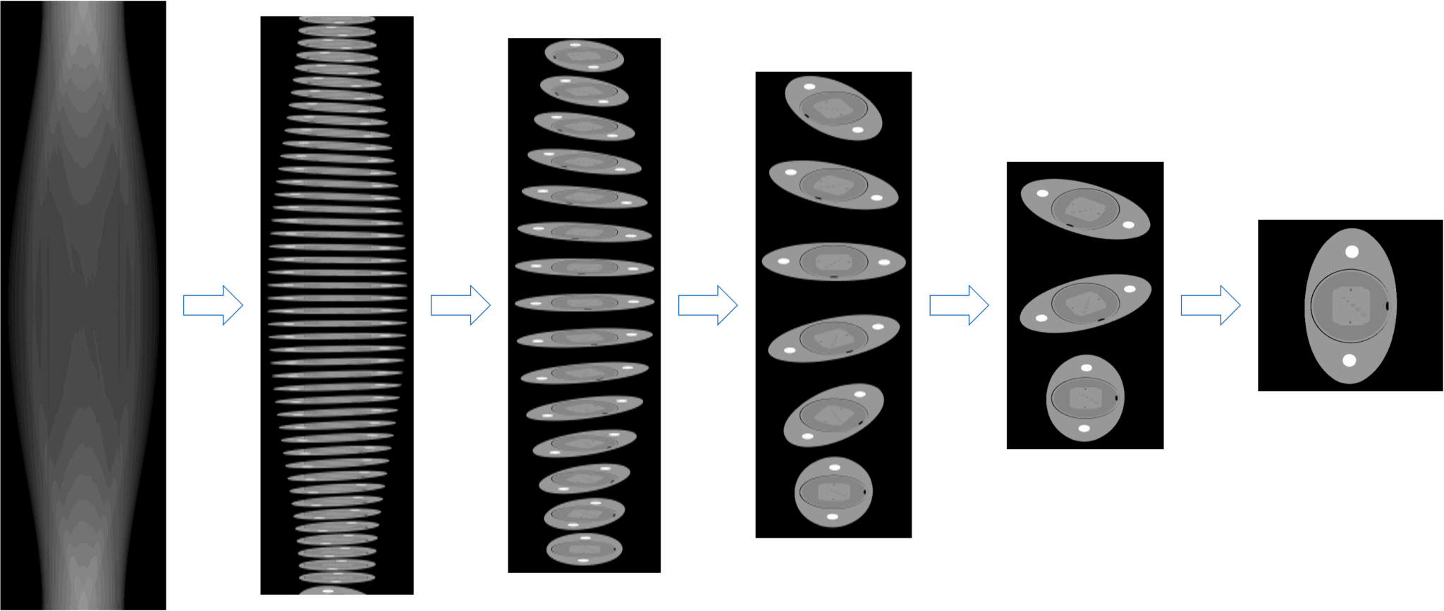 Sustainable AI in medical imaging: How GE HealthCare helps pioneer ...