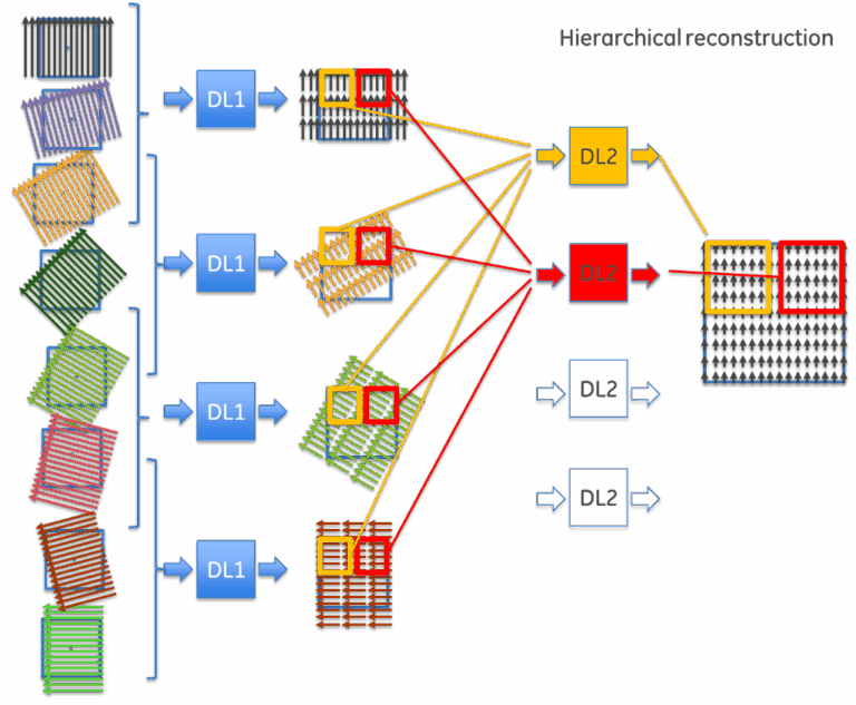 Sustainable AI in medical imaging: How GE HealthCare helps pioneer ...